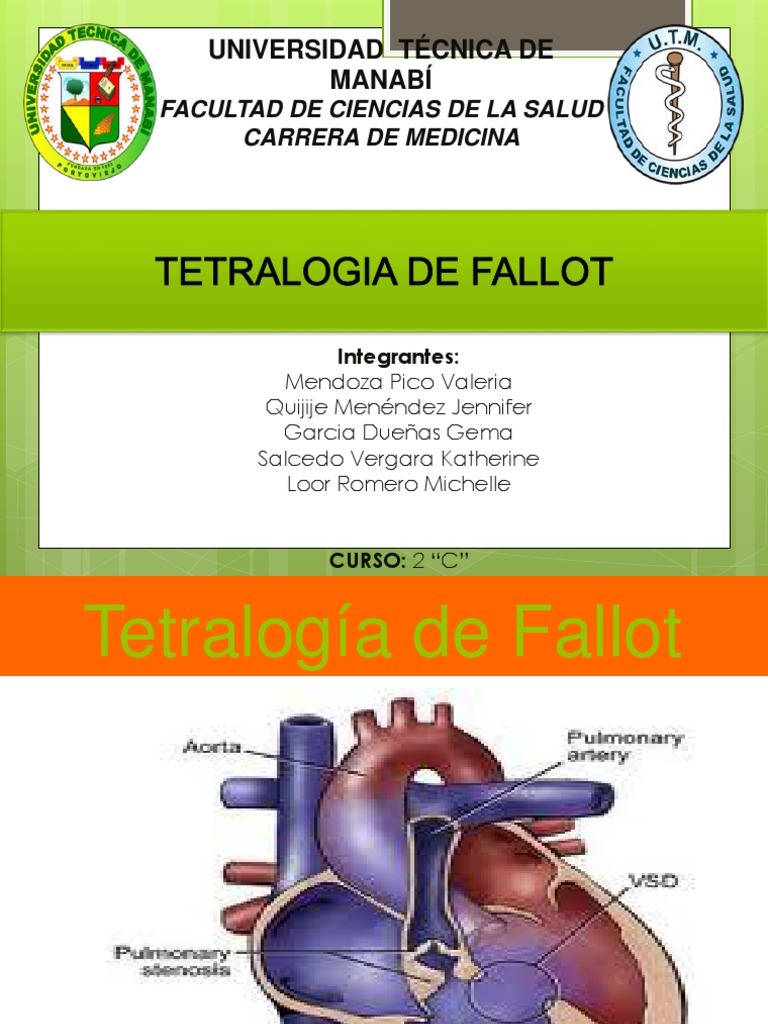 Tetralogía De Fallot Pdf Pulmón Arritmia Cardiaca
