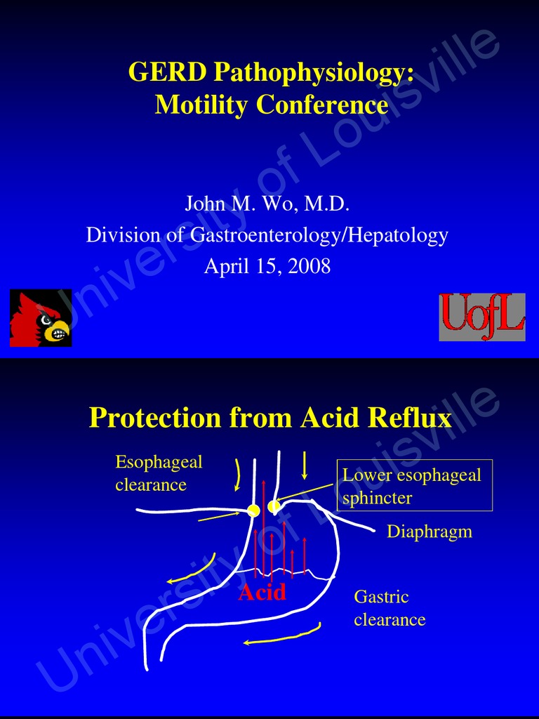 GERD Pathophysiology | Heartburn | Gastroesophageal Reflux Disease