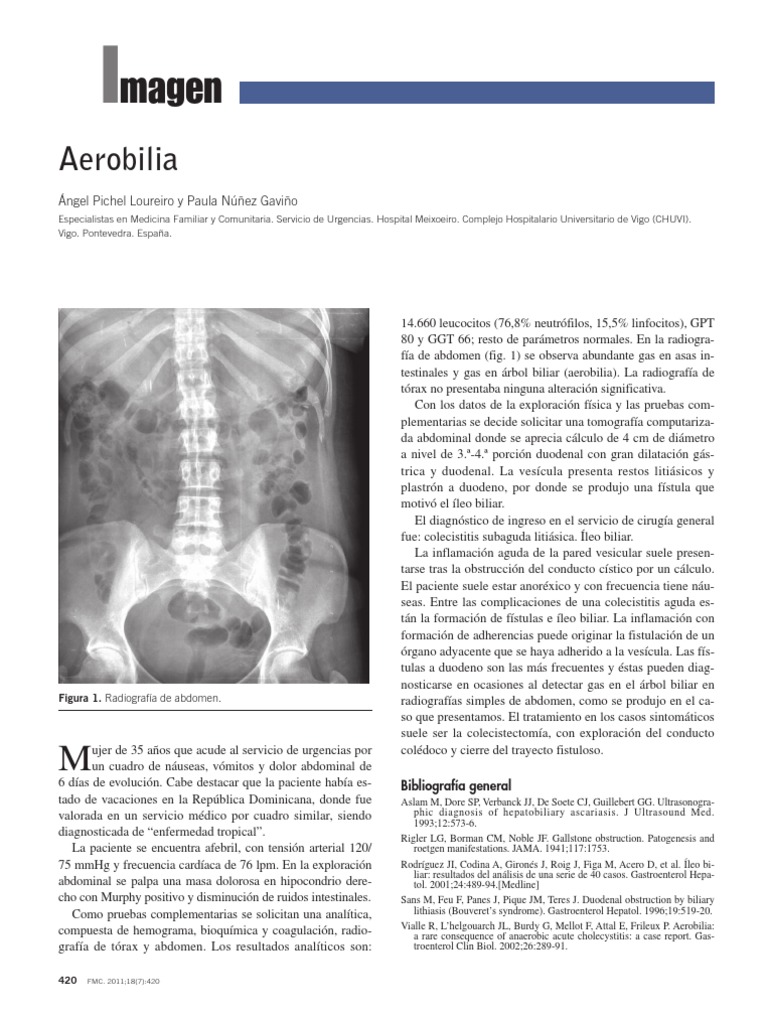 Aerobilia: Causas y Diagnóstico | PDF | Gastroenterología ...