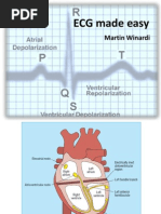 ECG Interpretation Simplified | PDF | Electrocardiography | Heart