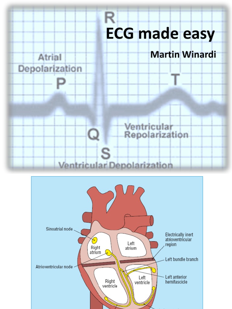 ECG Made Easy: A Guide to 12-Lead Interpretation | PDF