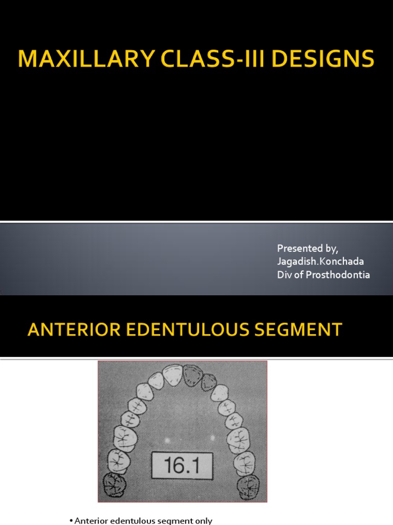 Maxillary Class-III Designs | PDF | Dentures | Physiognomy