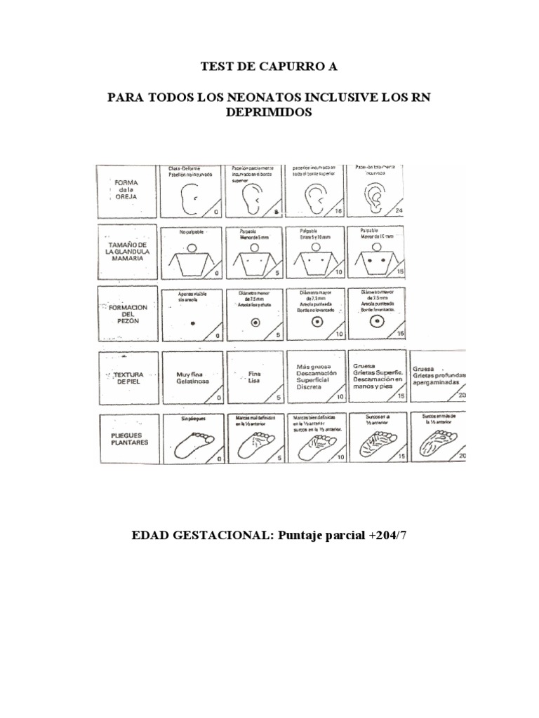 Test de Capurro a y b