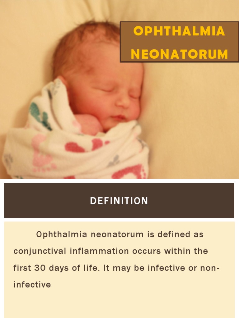 Ophthalmia Neonatorum: Causes, Symptoms, and Treatment of Neonatal ...