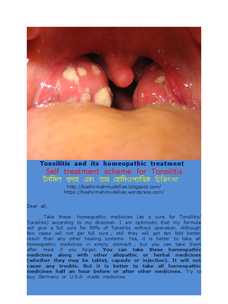 Tonsilitis and Its Homeopathic Self Treatment Scheme DR Bashir Mahmud Ellias | PDF | Homeopathy ...