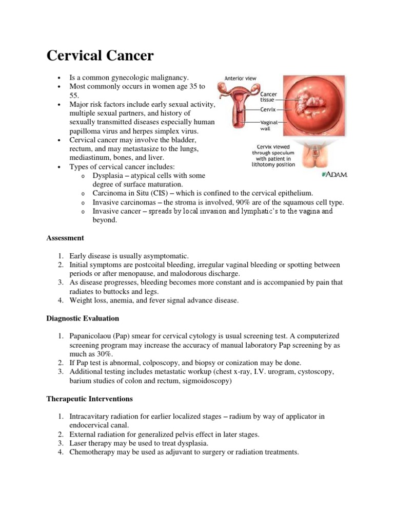 Cervical Cancer | Cervical Cancer | Cancer