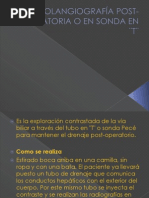 Colangiografía por Sonda T: Guía Completa | PDF | Bilis | Hígado