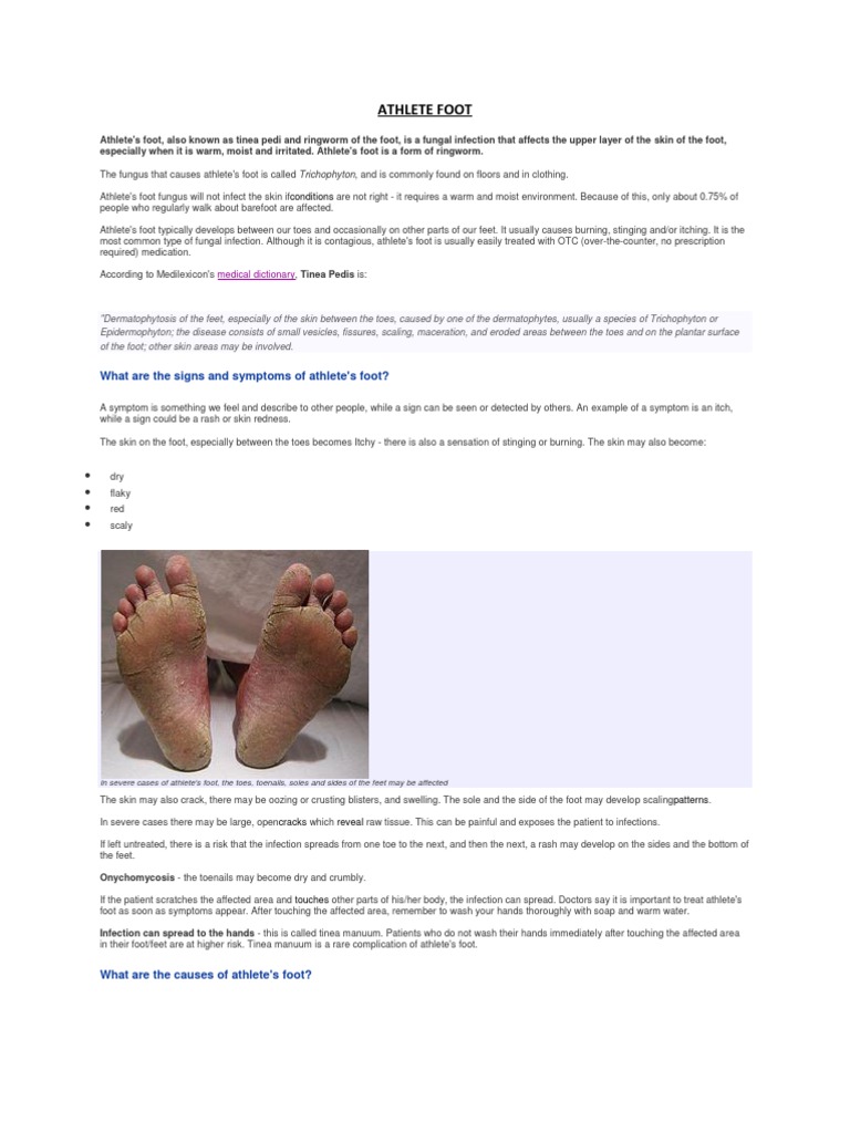 Athlete Foot | PDF | Rtt | Microbiology