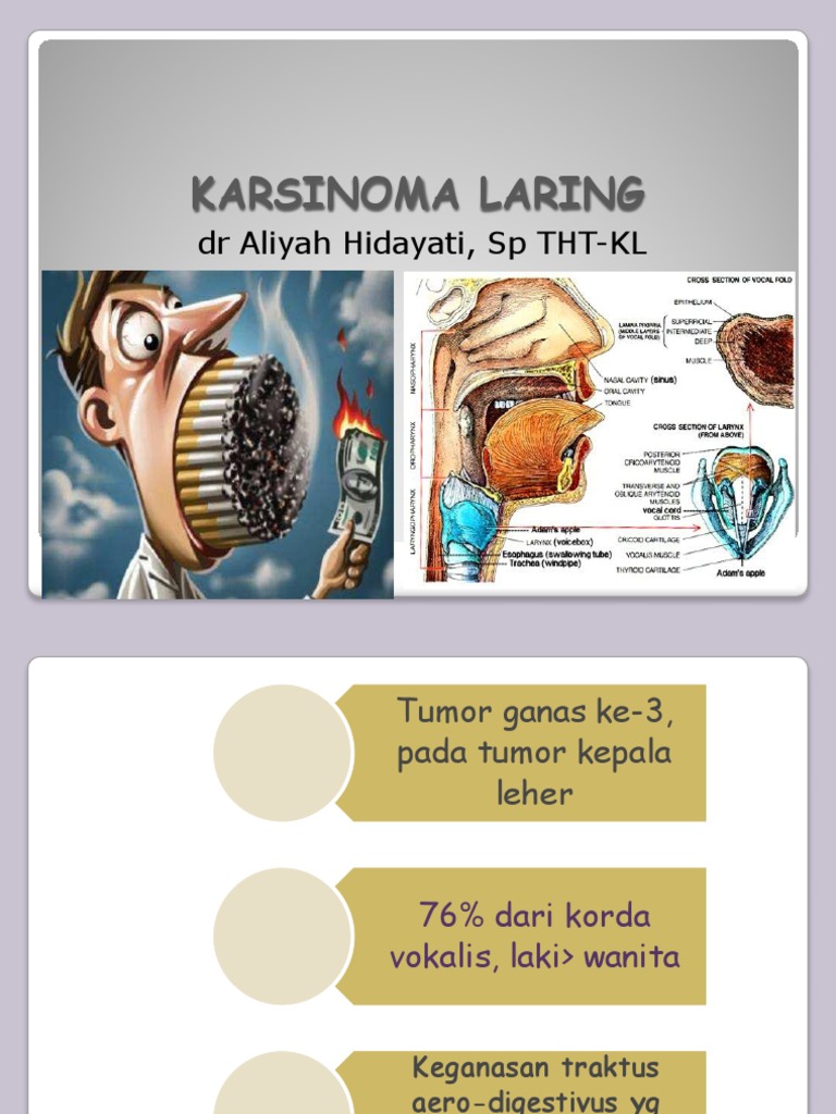 Ca Laring Edt Nsalndlasd PDF | PDF