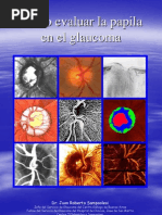 Anatomía y Patología de La Papila Óptica | PDF | Retina | Ojo humano