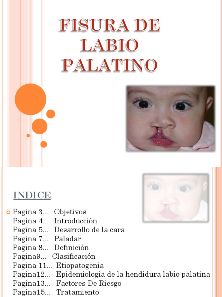 Labio Palatino PDF | PDF | Ciencias de la Salud | Medicina