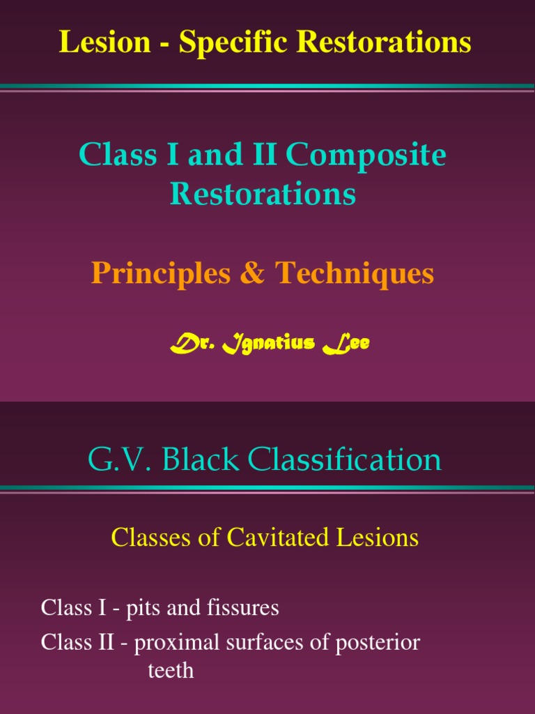 Class I and II Composite Restorations Guide | PDF