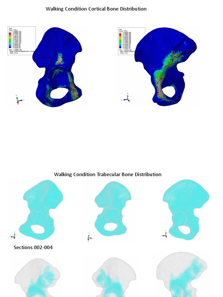 Bone Distribution Analysis by Condition | PDF