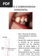 Clasificación de Angle y Maloclusiones | PDF | Boca | Diente