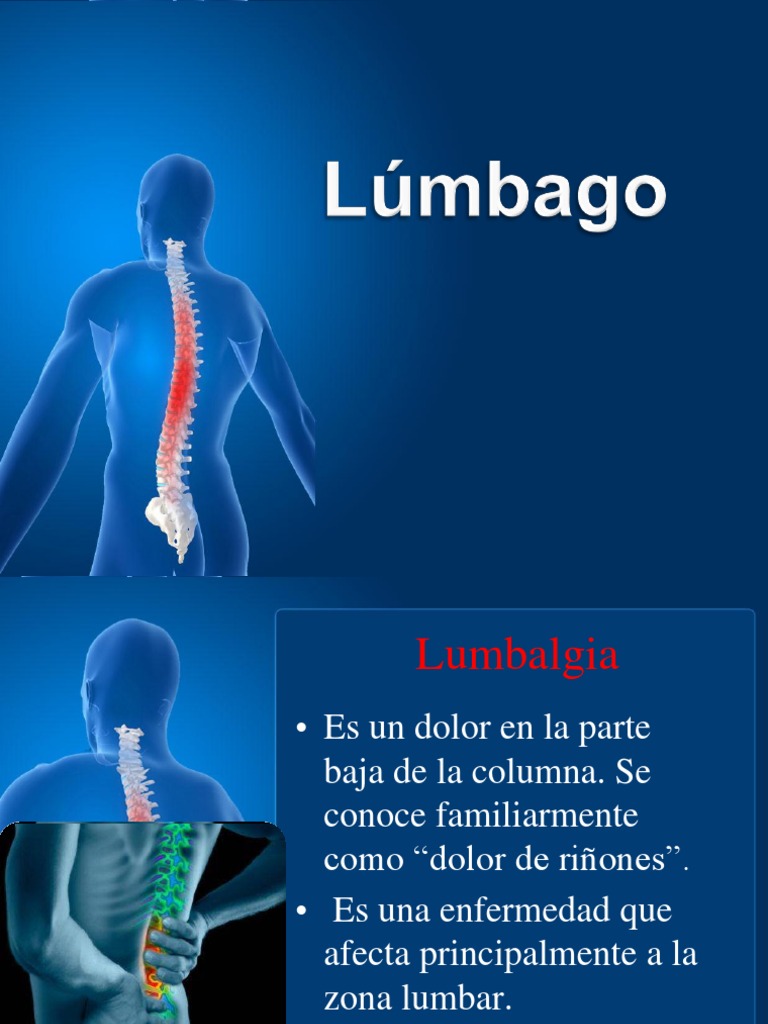 Lumbalgia: Causas y Tratamientos | PDF | Dolor lumbar | Medicina