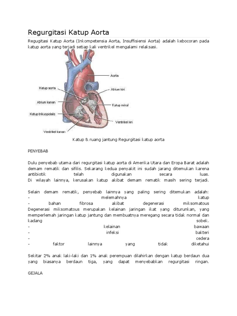 Regurgitasi Katup Aorta | PDF
