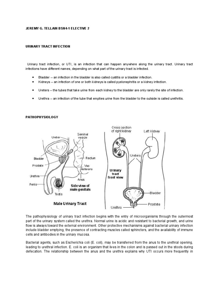 Elective 2 Report | PDF | Urinary Tract Infection | Urinary System