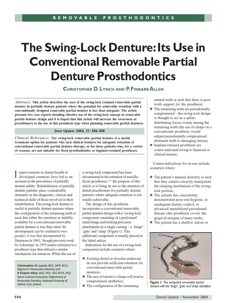 The Swing-Lock Denture - Its Use in Conventional Removable Partial ...