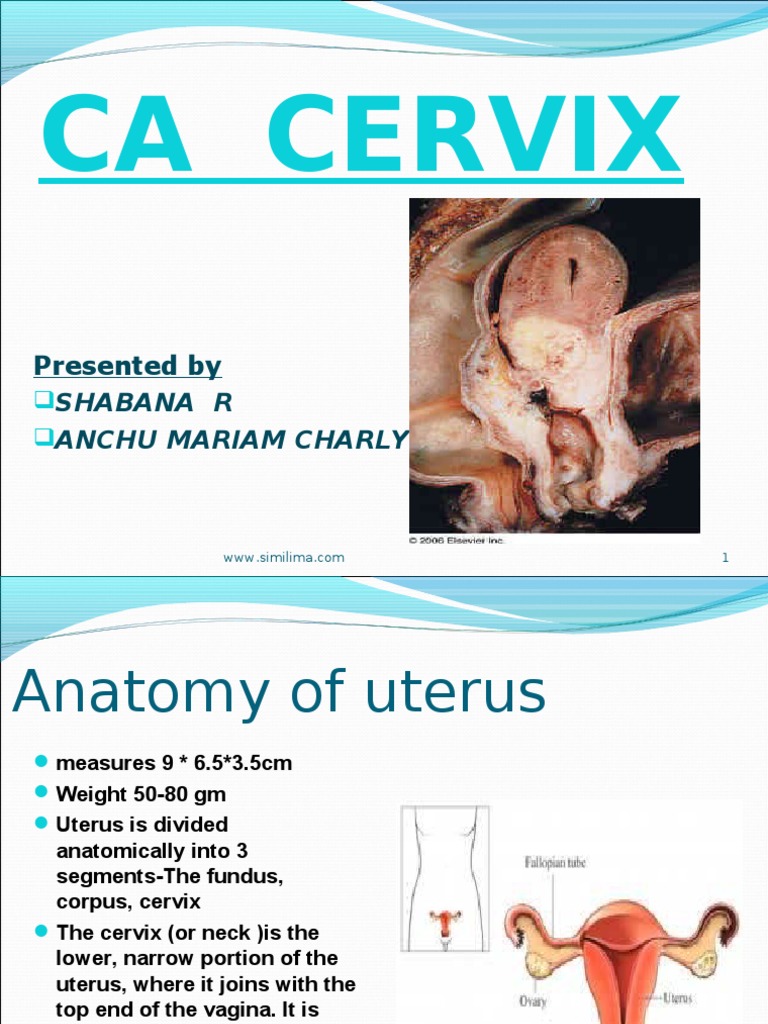 Ca Cervix: Shabana R Anchu Mariam Charly | Download Free PDF | Cervical ...