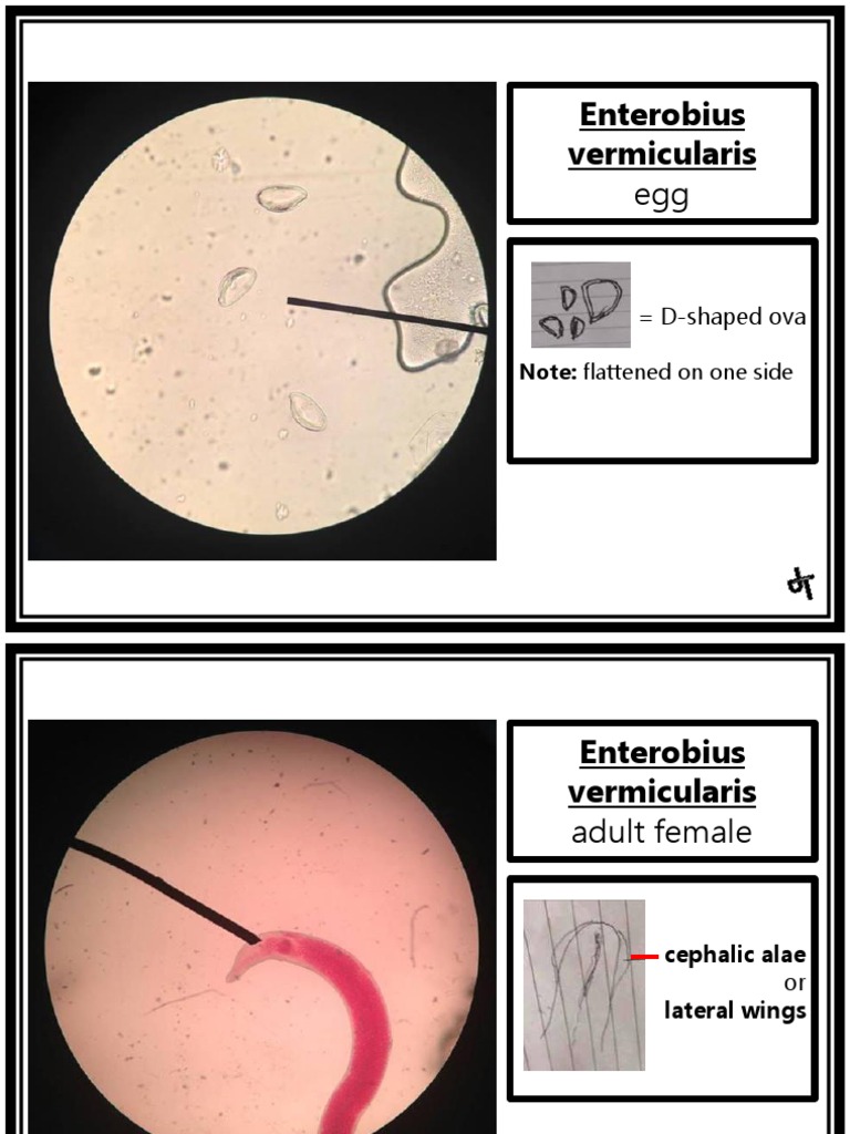 Enterobius Vermicularis Egg and Female Features | PDF