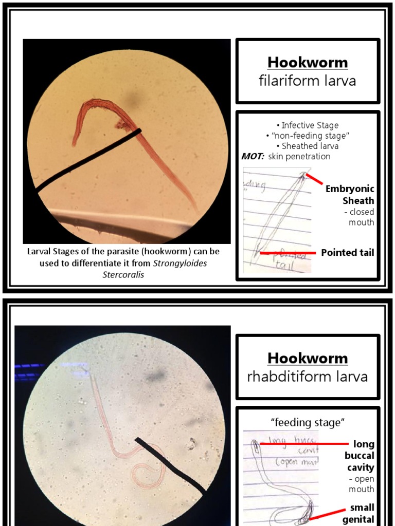 Parasitology (Laboratory) - NEMATODES - Hookworms | PDF