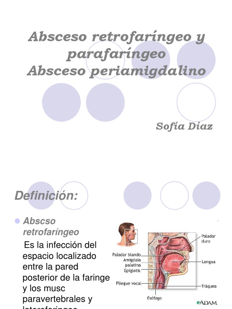 Absceso retrofaríngeo y parafaríngeo | Medicina | Medicina CLINICA