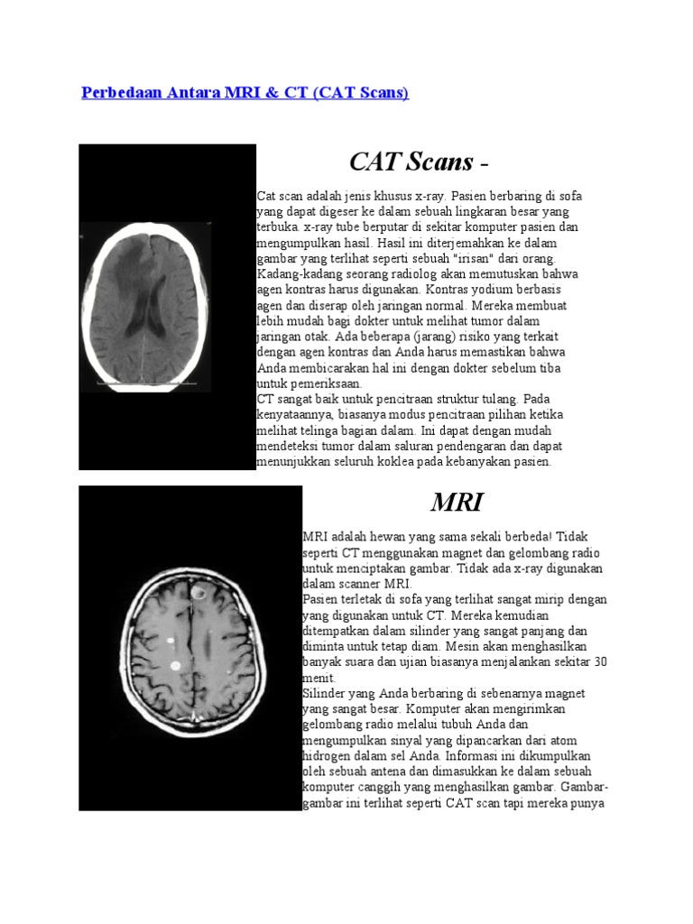 Perbedaan Antara MRI Dan CT Scan | PDF