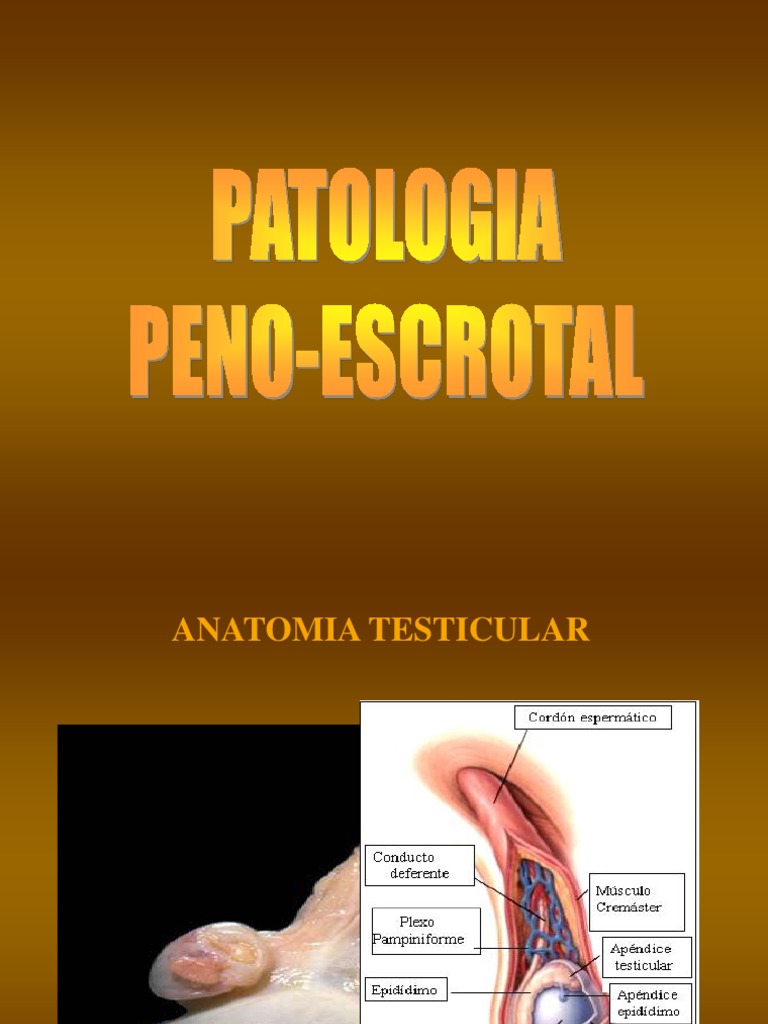 Escroto Agudo Mod 2011 | PDF | Testículo | Ciencias de la Salud