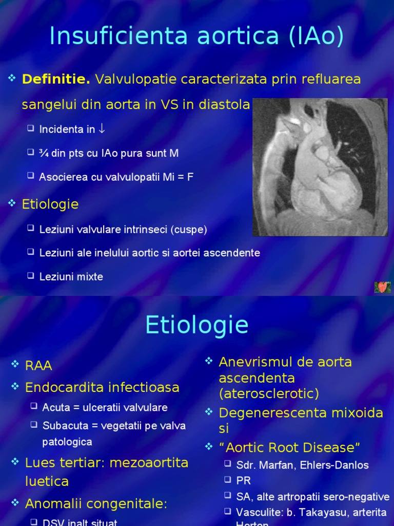 Insuficienta Aortica | PDF
