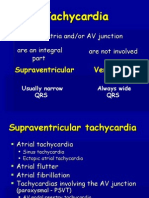 Atrial Fibrillation:Flutter in Pre-Excitation - LITFL - ECG Library ...