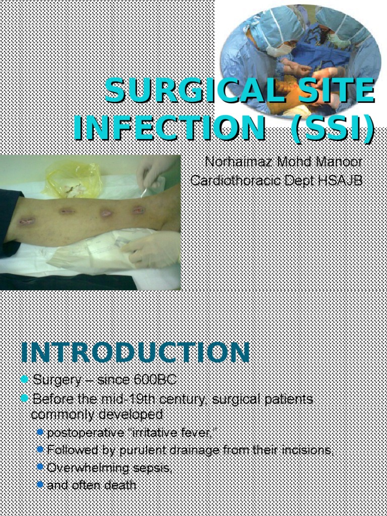 Surgical Site Infections | Surgery | Infection
