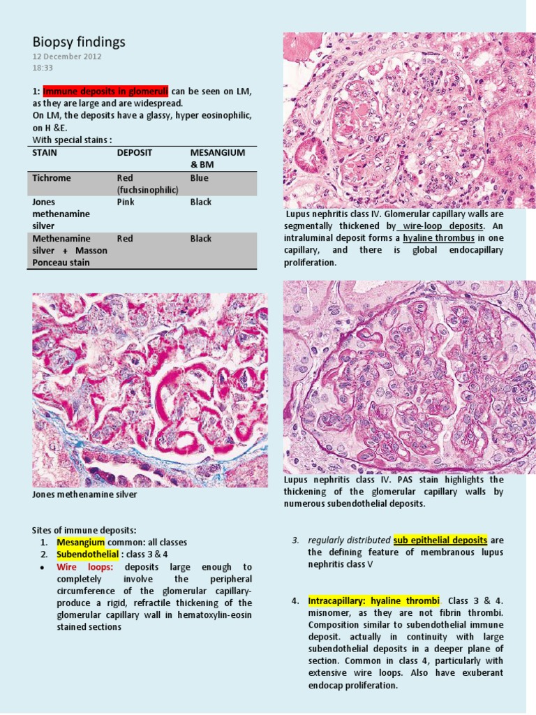 Biopsy Findings | Systemic Lupus Erythematosus | Necrosis | Free 30-day ...