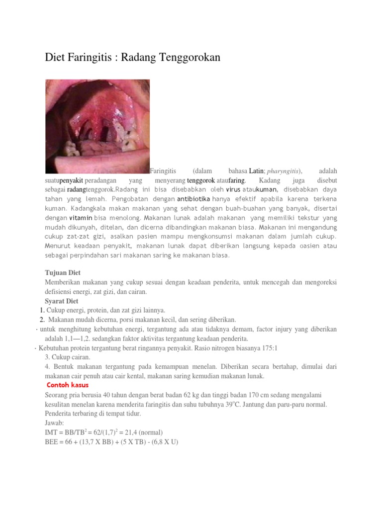 Faringitis Akut + Gambar | PDF