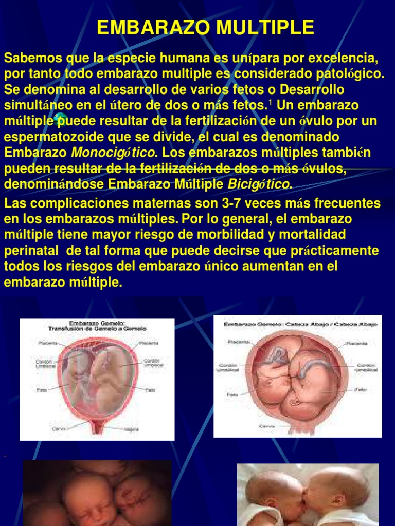 Embarazo Multiple | PDF | Nacimientos Múltiples | Gemelo