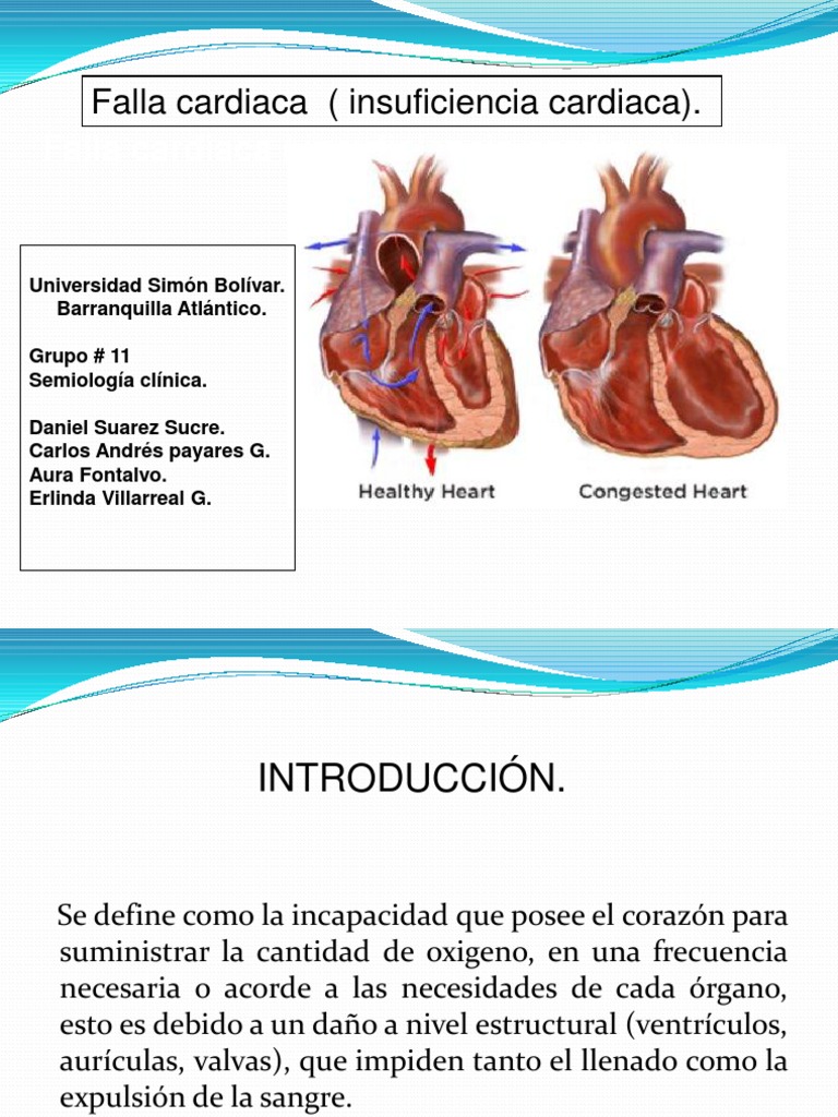 Falla Cardiaca ( Insuficiencia Cardiaca)