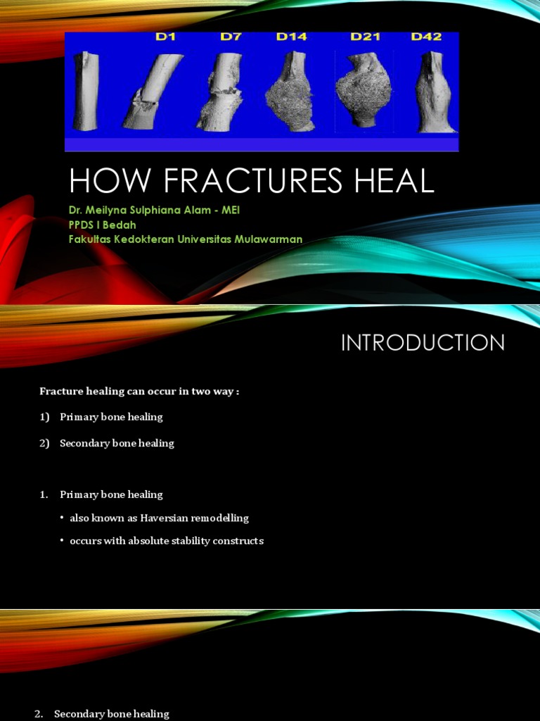 Understanding Fracture Healing Processes | PDF | Bone | Osteoblast