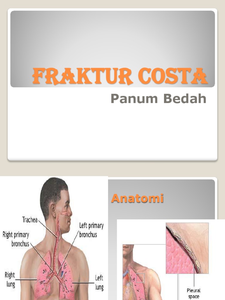 Penanganan Fraktur Costa dan Prognosis | PDF
