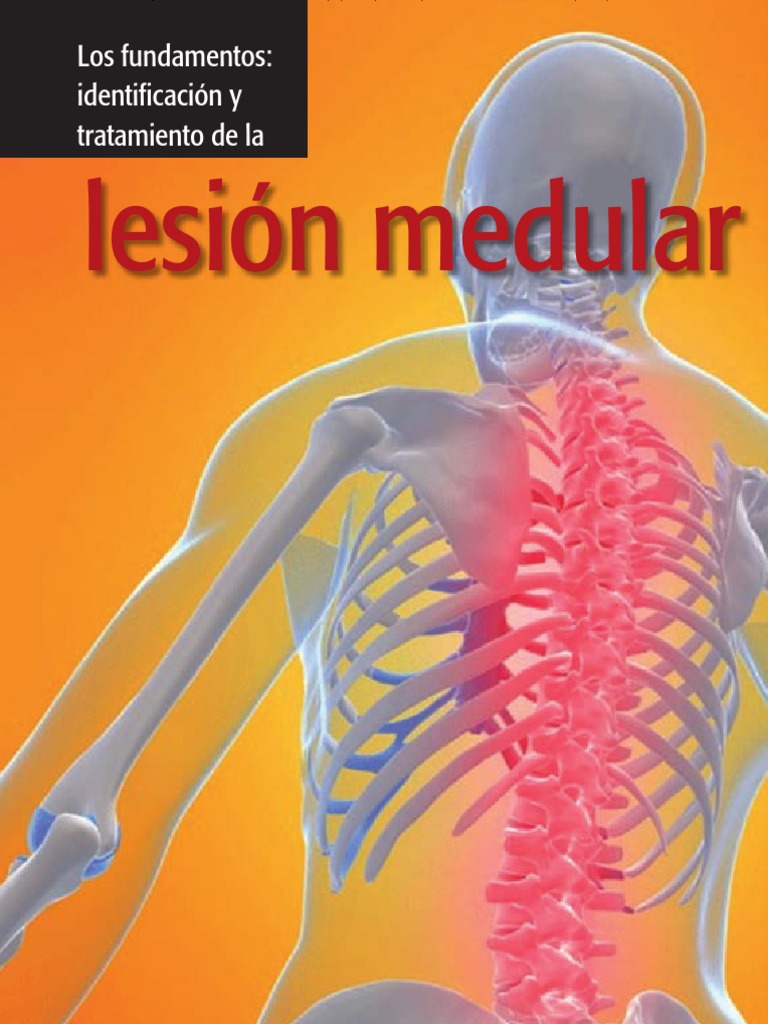 Lesion Medular | Médula espinal | Lesión