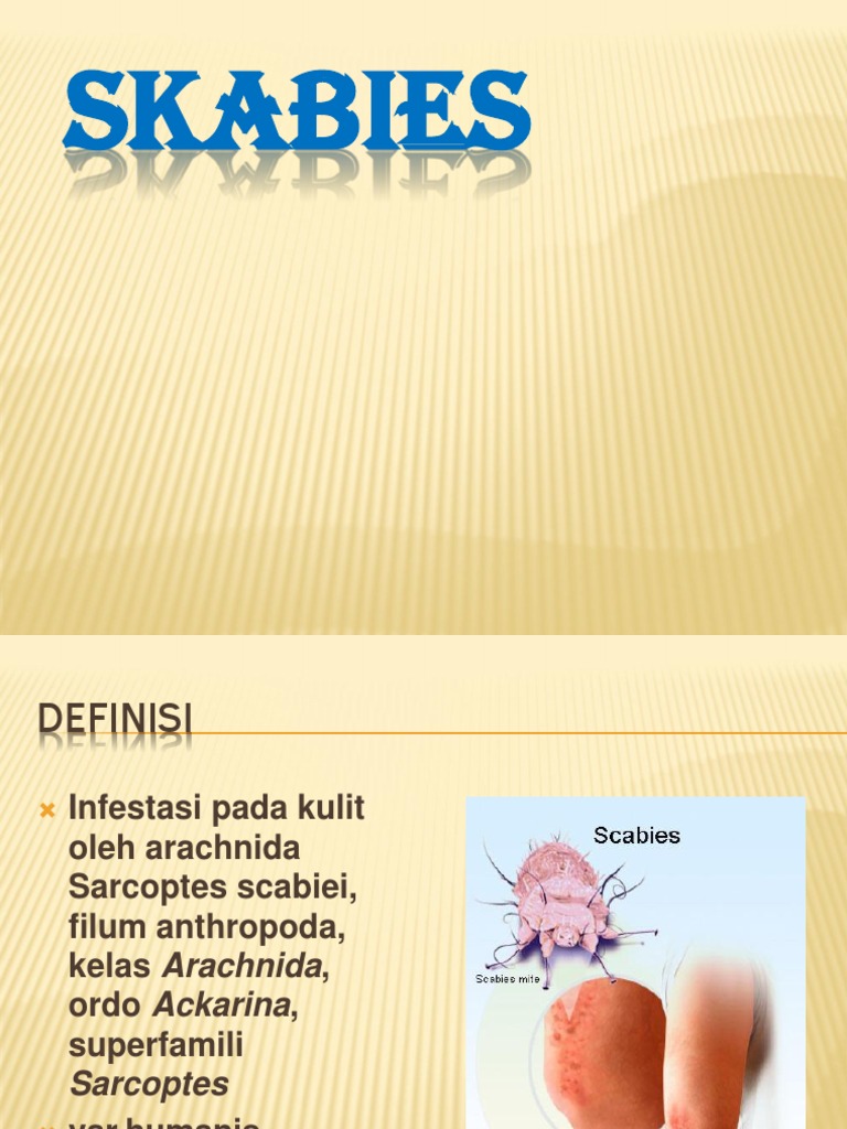 Skabies