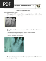 Protocolo Pulpotomia | PDF