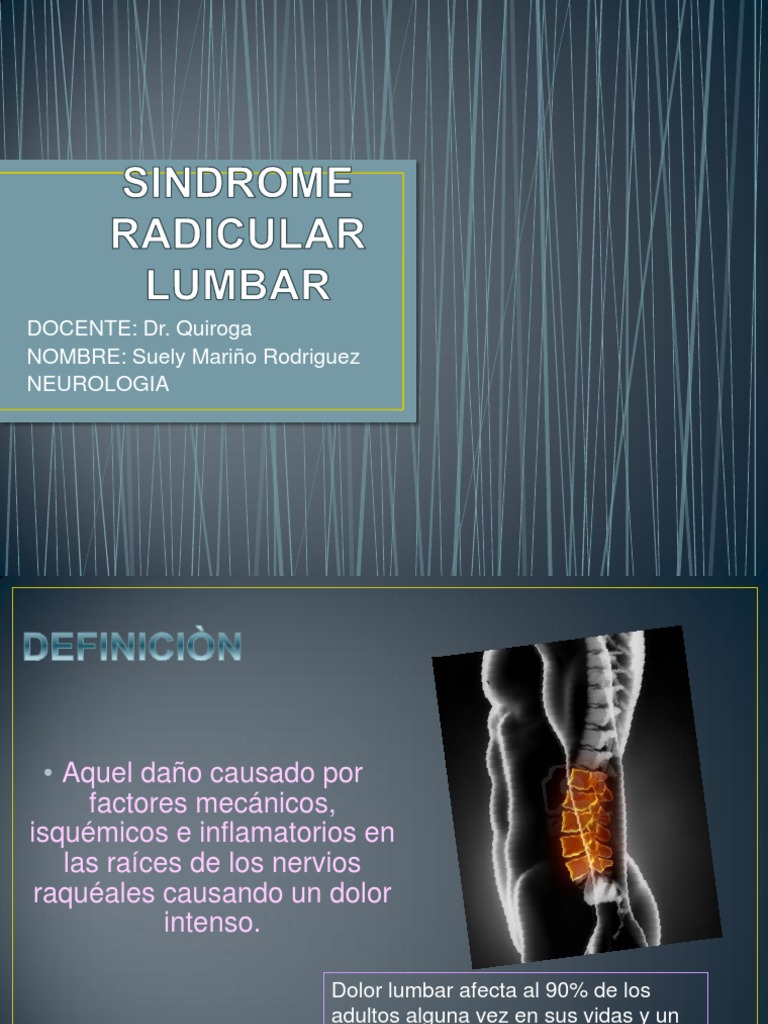 Síndrome Radicular Lumbar: Causas y Tratamientos | PDF | Enfermedades y ...