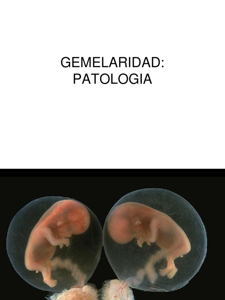 Tipos y Patologías de Gemelaridad | PDF | Siameses | Gemelo