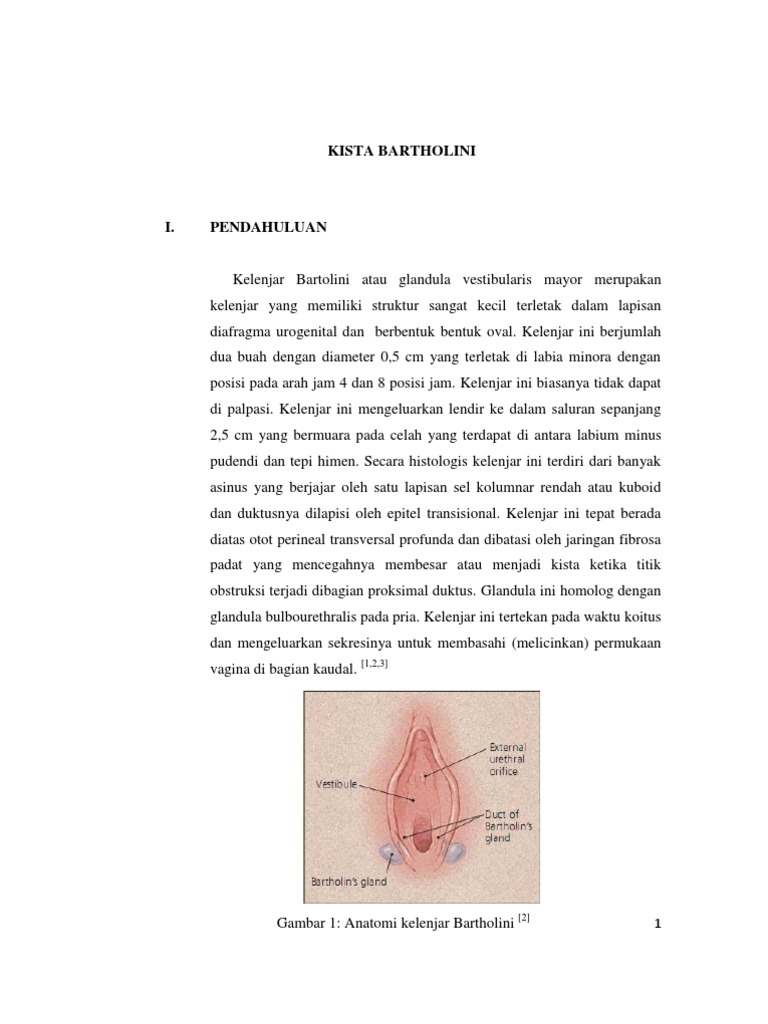 Kista Bartholini Fix | PDF