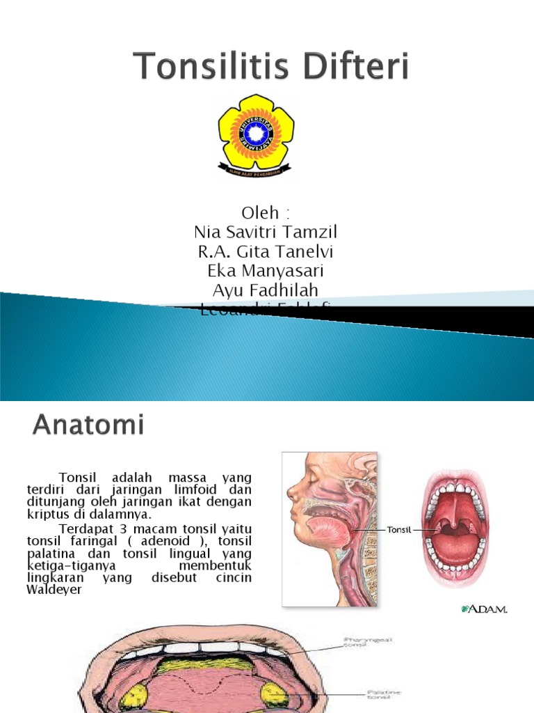 Tonsilitis Difteri Upload | PDF