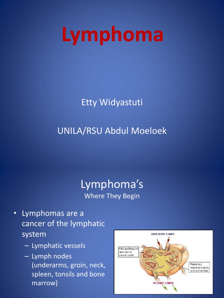 Lymphoma | PDF | Lymphoma | Lymphatic System
