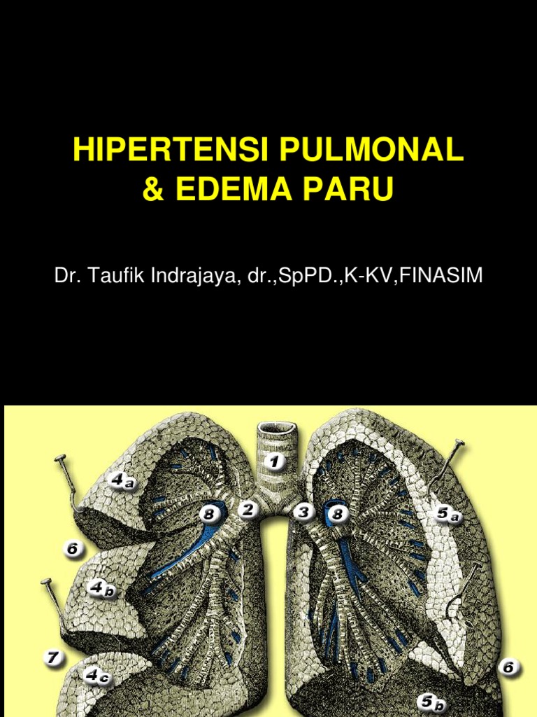 Hipertensi Pulmonal & Edema Paru: Dr. Taufik Indrajaya, DR.,SPPD.,K-KV, Finasim | PDF | Heart ...