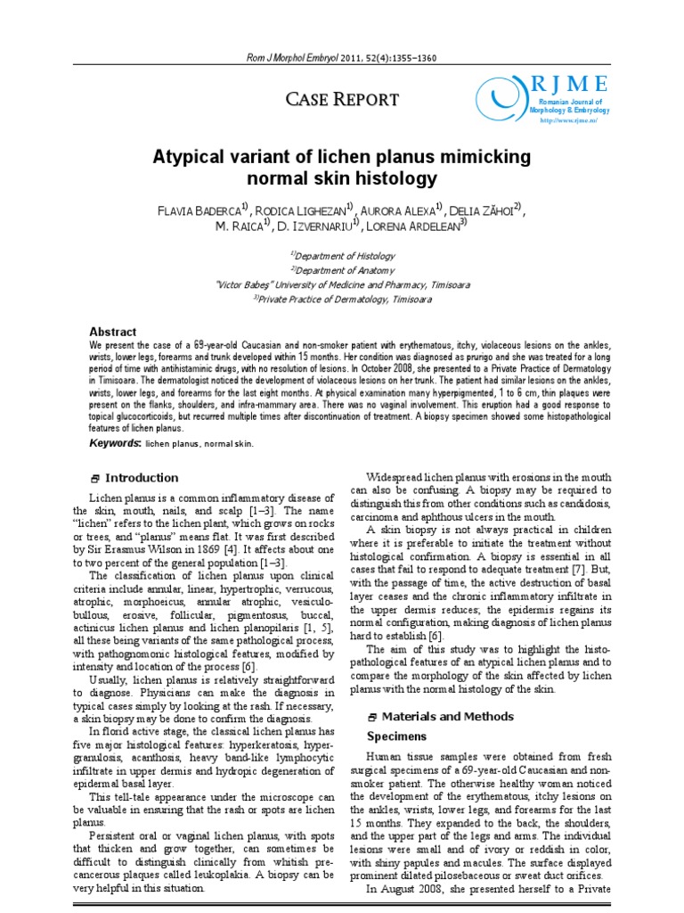 Liken Planus | PDF | Epidermis | Cutaneous Conditions