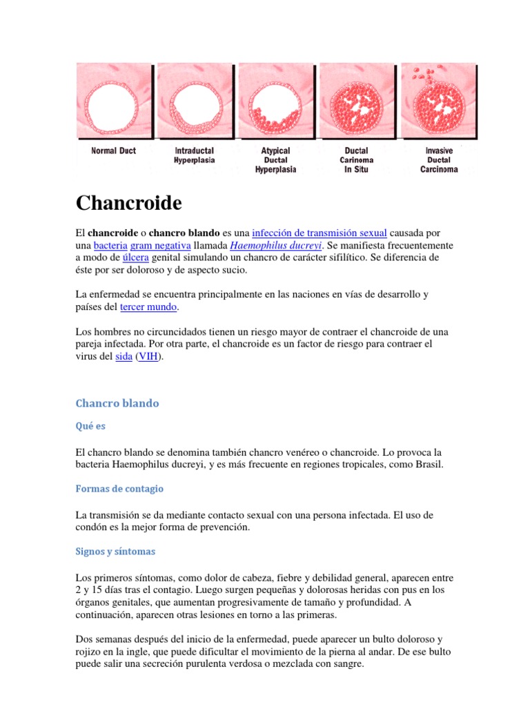 Chancroide: Síntomas y Tratamiento | PDF | Infección transmitida ...