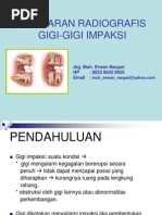 Klasifikasi Impaksi Full | PDF