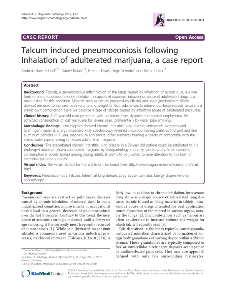 Talcum Induced Pneumoconiosis Following Inhalation of Adulterated ...